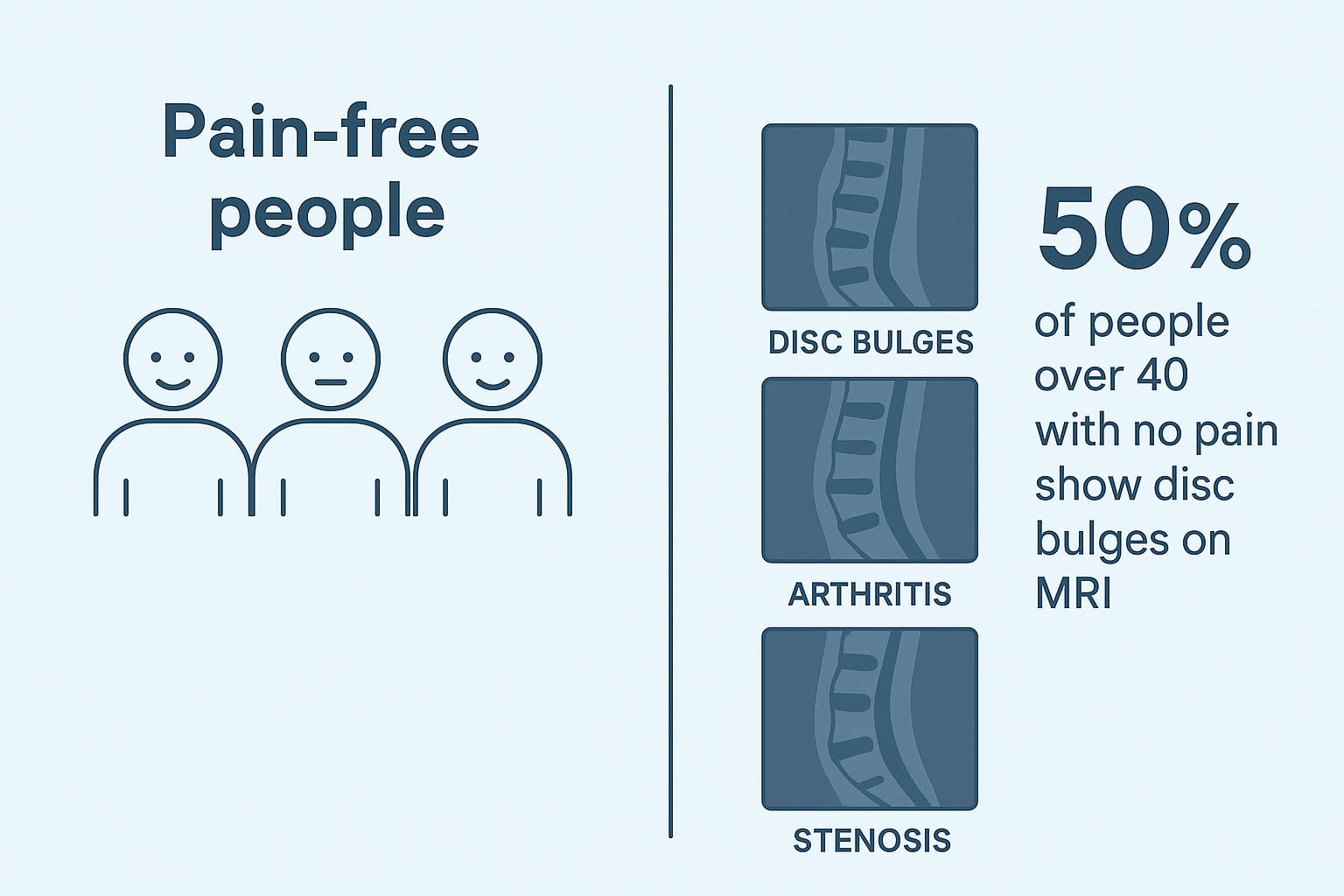 Why Scans Don’t Show the Cause of Lower Back Pain - On Path Physio